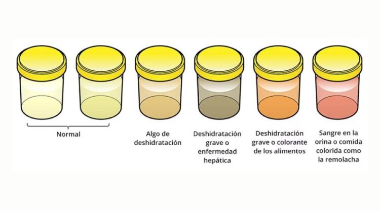 ¿Qué dice sobre tu salud el color de tu orina?