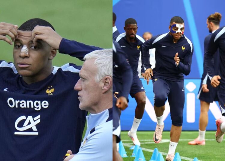 Mbappé mostró su rostro por primera vez tras la fractura de nariz