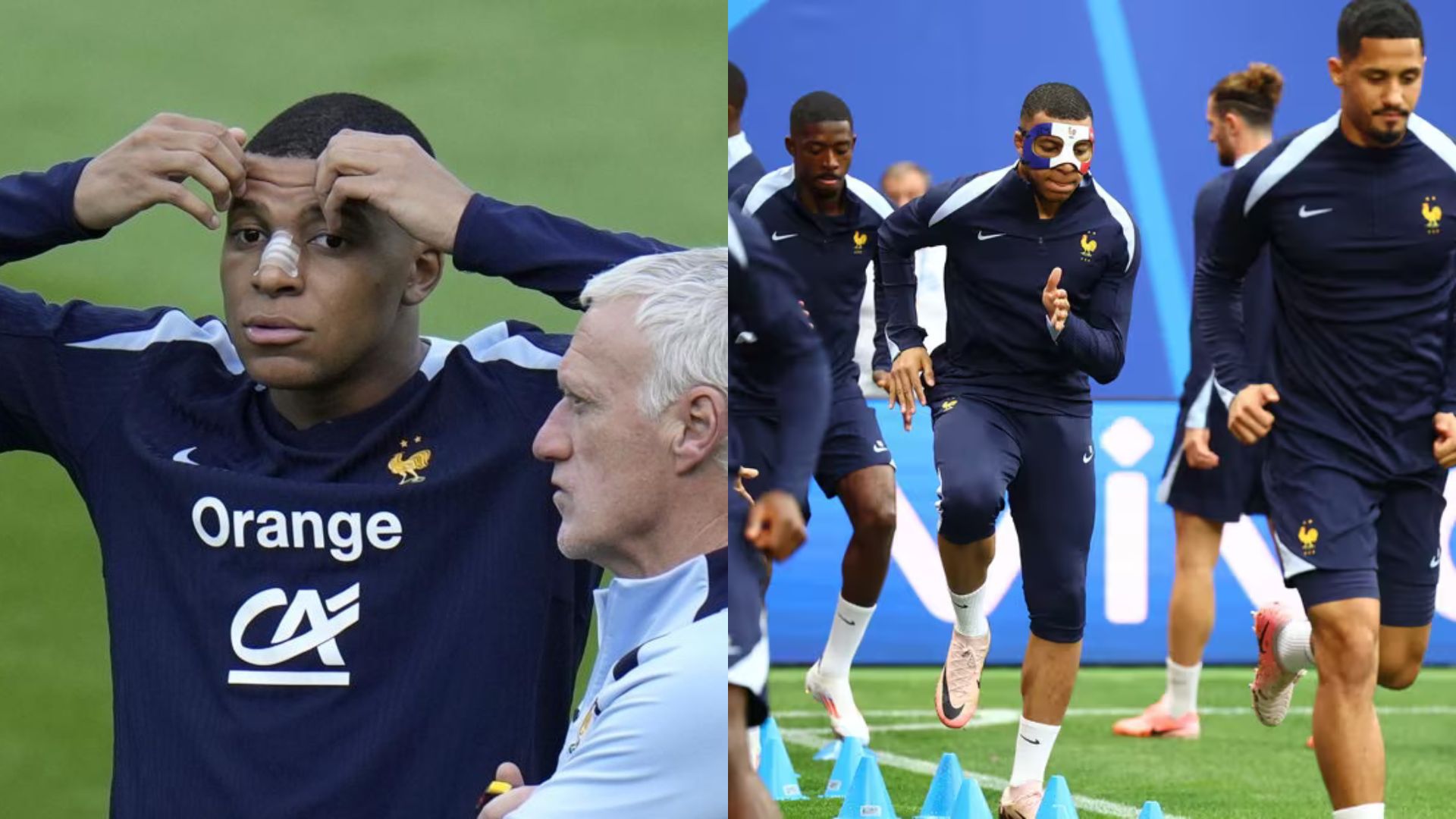 Mbappé mostró su rostro por primera vez tras la fractura de nariz