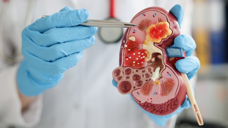 ¿Sabías que el 13 de marzo es el Día Mundial del Riñón?